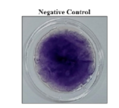 Comparative Cytotoxicity Assessment of Cobalt-Chromium-Molybdenum Casts ...