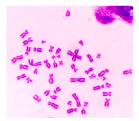 Genotoxicity Assessment of Ultra-High Molecular Weight Polyethylene ...