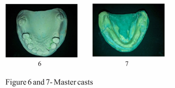 Full mouth rehabilitation with implant-supported fixed dental ...