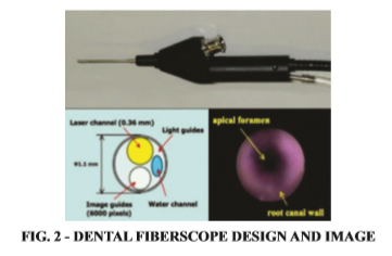 Improvement Of Dental Fiberscope Navigation System For Endodontic ...