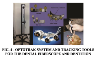 Improvement Of Dental Fiberscope Navigation System For Endodontic ...